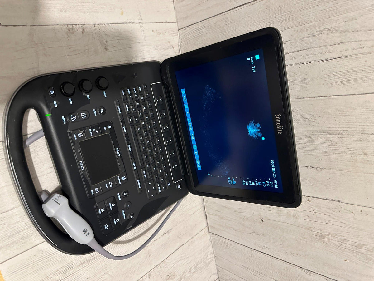 Sonosite Edge II Ultrasound 2016, DICOM with Phased Array probe rP19x – KeeboMed