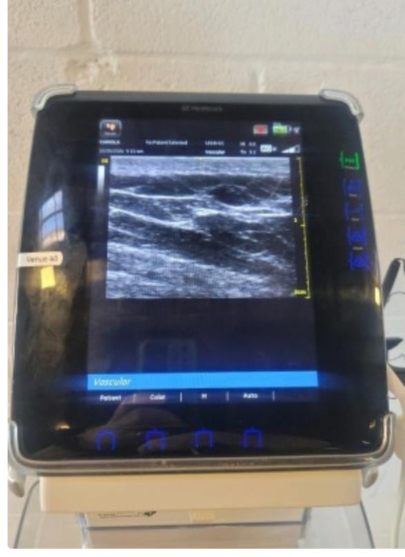 GE VENUE 40 Ultrasound Machine with L8-18I Probe on the Stand – KeeboMed