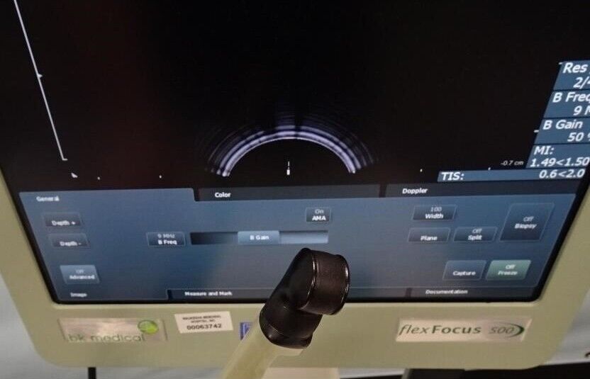 BK Medical Flex Focus 500 Ultrasound System with two probes 8818 and 8 ...