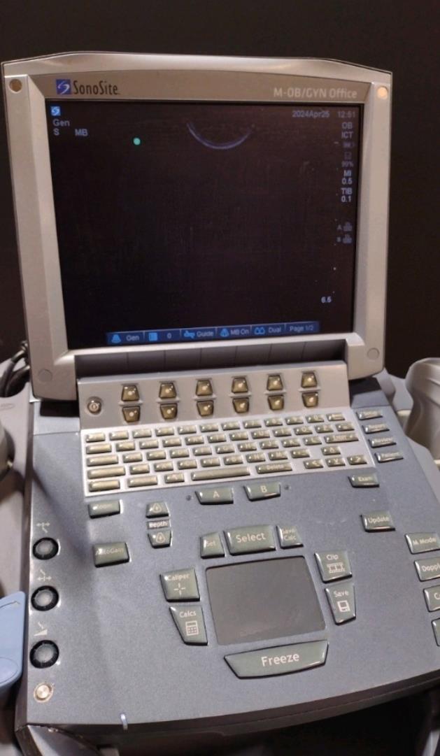 SONOSITE M-OB/GYN PORTABLE ULTRASOUND MACHINE WITH 2 PROBES (C60X/5-2 ...