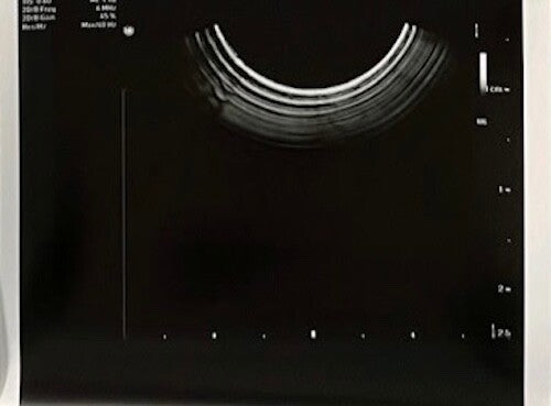 BK Medical Ultrasound Probe E14C4t (9018) Endo - Vaginal TV – KeeboMed