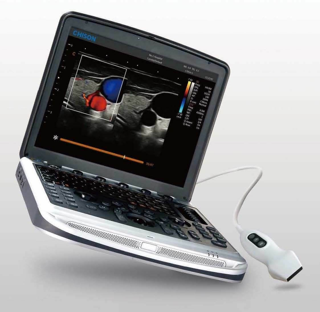 Chison Sonobook 9 Color Doppler Ultrasound with 2 probes cardiac ad va ...