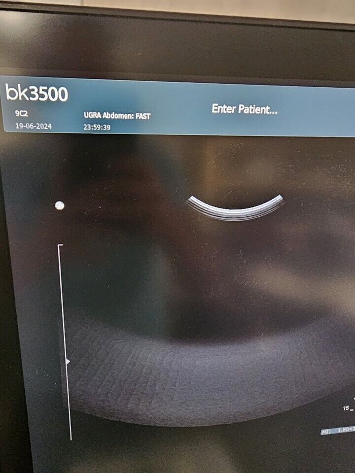 BK B&K Medical BK3500 Ultrasound With 9C2 Probe -2017 – KeeboMed