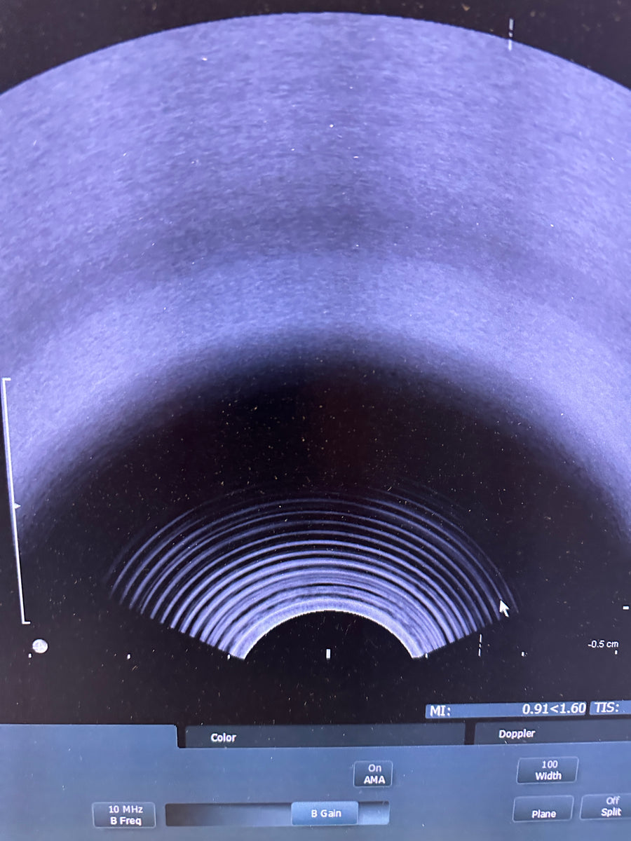 BK Medical Ultrasound Probe BK 8808e Endo Vaginal Transducer TV probe ...