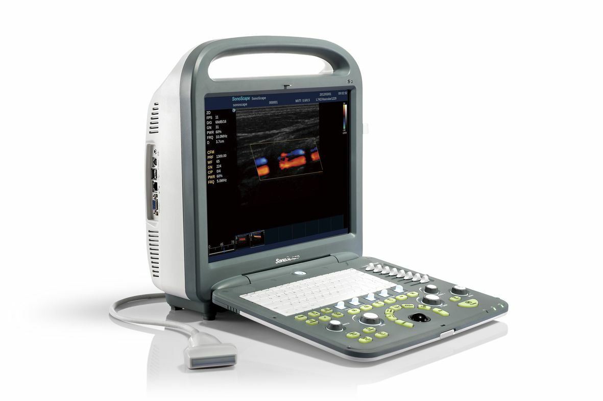 SonoScape S2 with Linear Array Probe for MSK, Vascular Ultrasound ...
