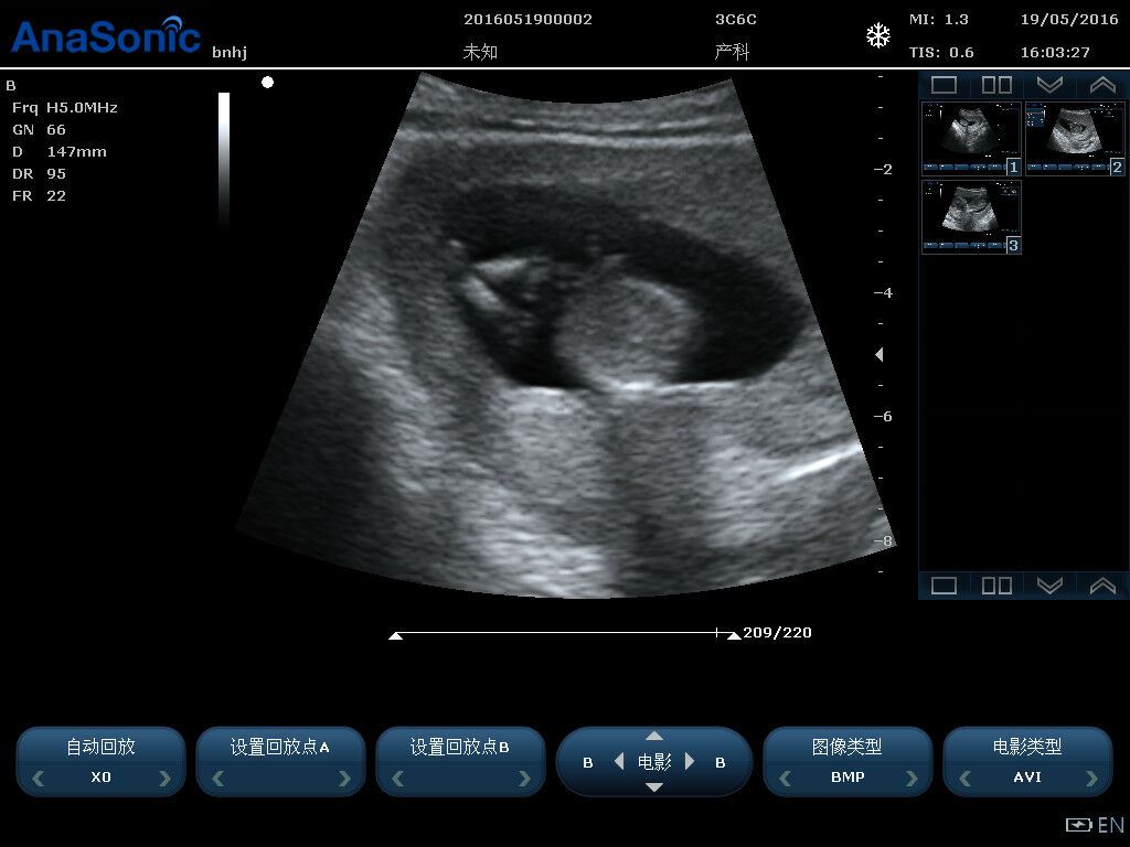 Veterinary Ultrasound Color Doppler, Quality Continuous Wave CW&Two Pr ...