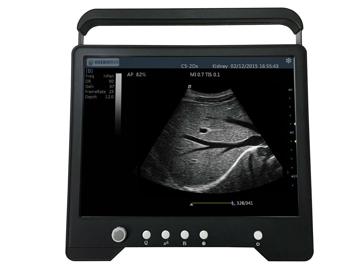 Veterinary Touch Screen Ultrasound with Rectal Probe for Large Animals ...