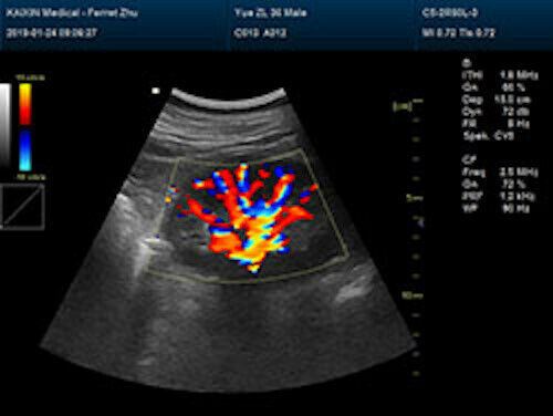 Newest- Color Portable Ultrasound & One Probe, DICOM, LED screen – KeeboMed