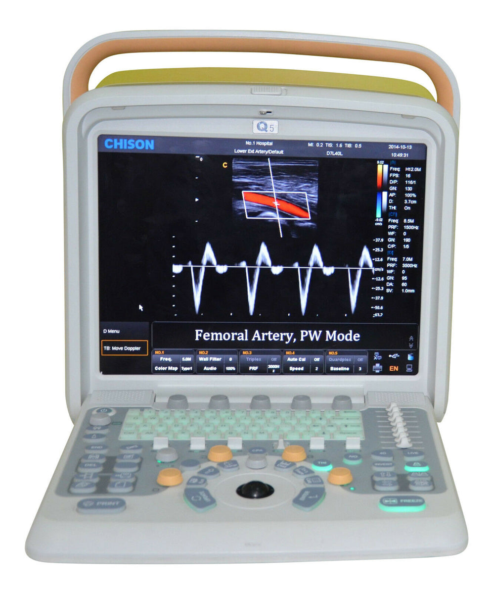 Color Doppler Ultrasound Scanner & Two probes Convex&Linear Probe - Ch ...
