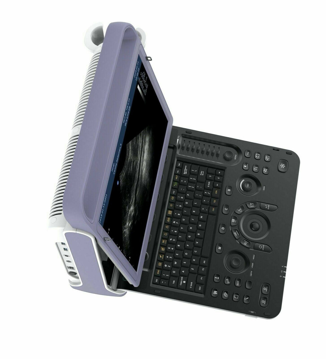 Chison eBit10 Amazing Quality Ultrasound with Linear Array Probe 5.0-1 ...