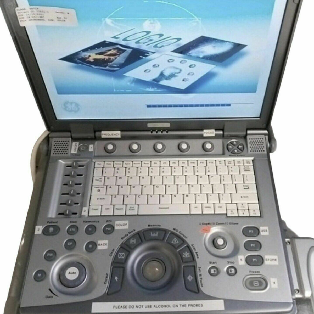 GE LOGIQ E PORTABLE ULTRASOUND MACHINE WITH 1 PROBE (12L) MANUFACTURED ...