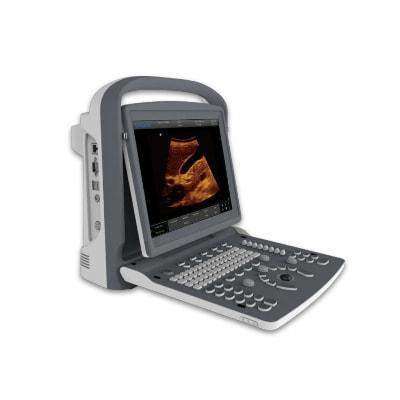 Chison ECO2 Black & White Ultrasound Machine | KeeboMed
