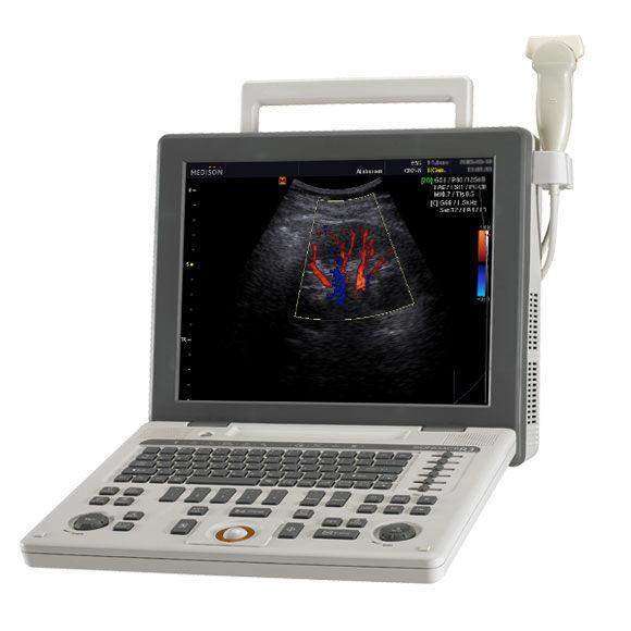 SonoVet R3-Medison Scanner | Ultrasound Equipment – KeeboMed