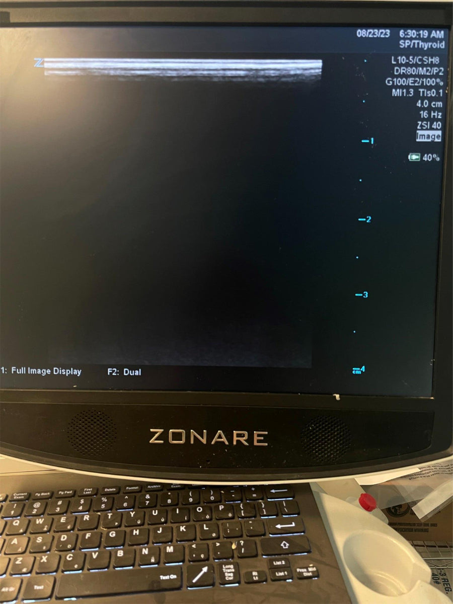 ZONARE L10-5 Ultrasound Probe Transducer – KeeboMed