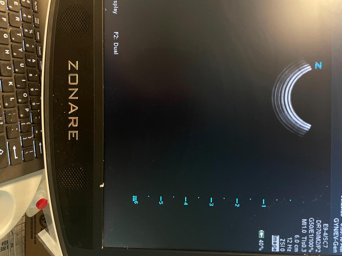 ZONARE E9-4 Ultrasound Probe Transducer – KeeboMed
