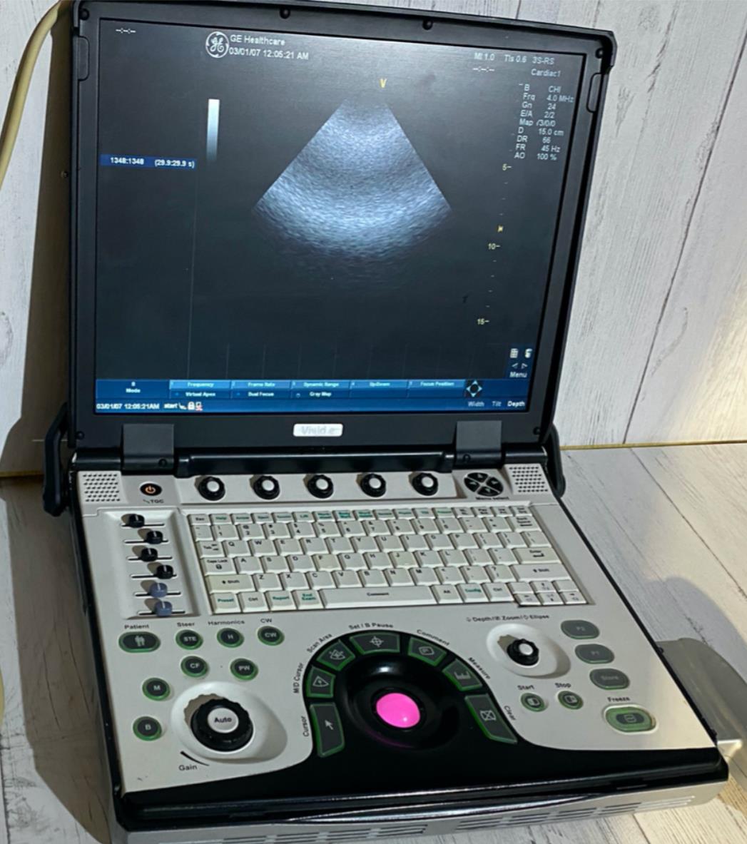GE Vivid E portable Ultrasound 2009 – KeeboMed