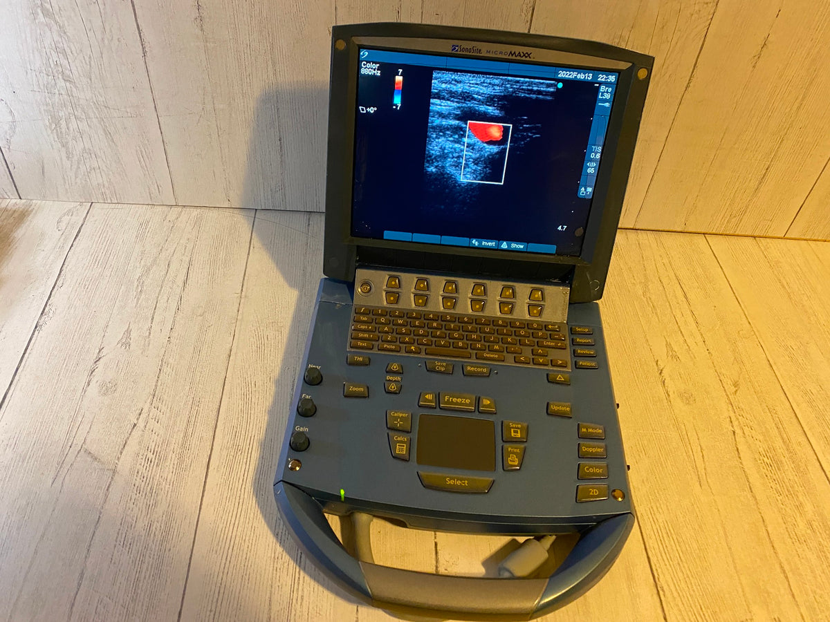 Sonosite MicroMaxx Portable Ultrasound 2007- Main unit – KeeboMed