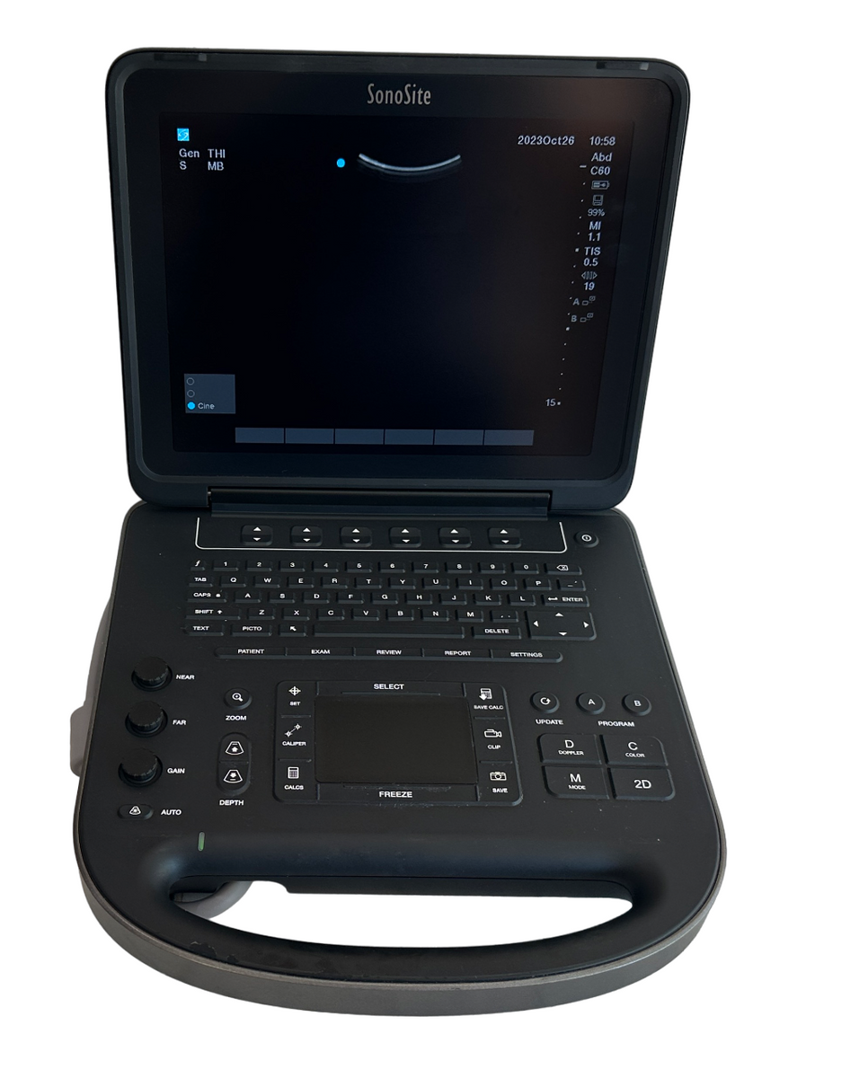 Sonosite Edge II Ultrasound 2017/Color Package DICOM, with rP19x Cardi ...