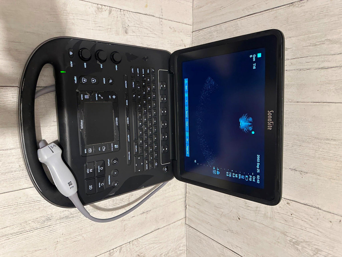 Sonosite Edge II Ultrasound 2016, DICOM with Phased Array probe rP19x – KeeboMed