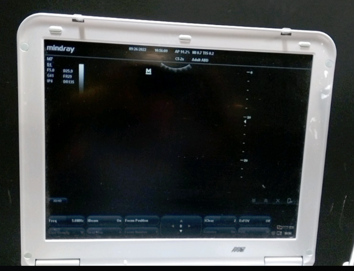 Advanced Ultrasound Mindray M7 with 3 Probes, Cart,Triple Probe Connec ...